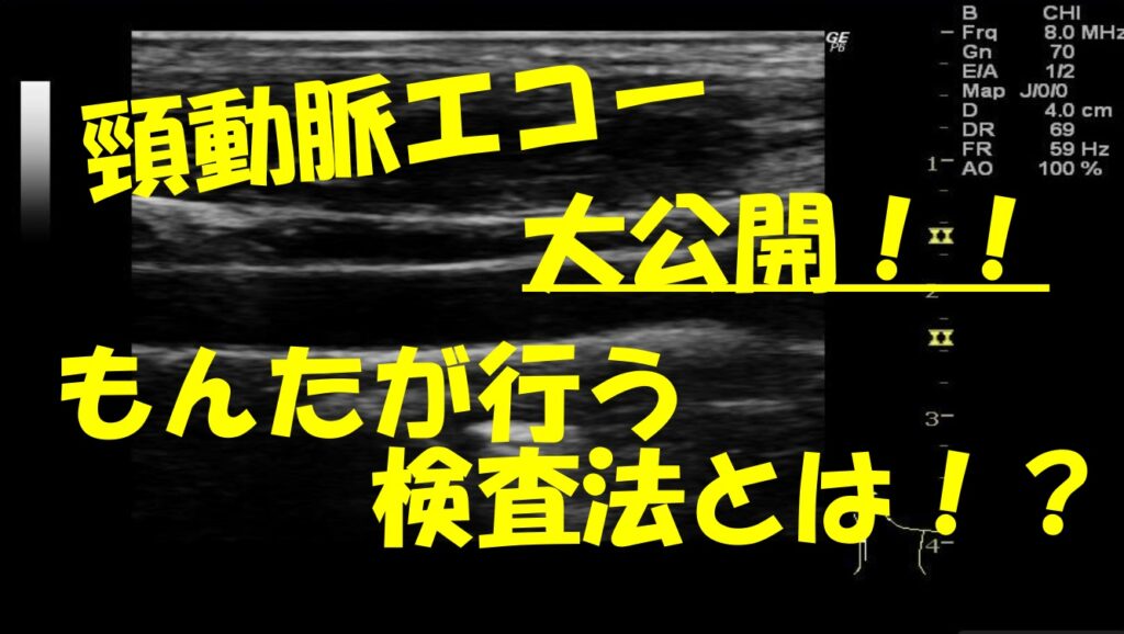 腹部エコー胆嚢・胆管解剖は？血管や胆管の走行は？ もんたの情報発信部